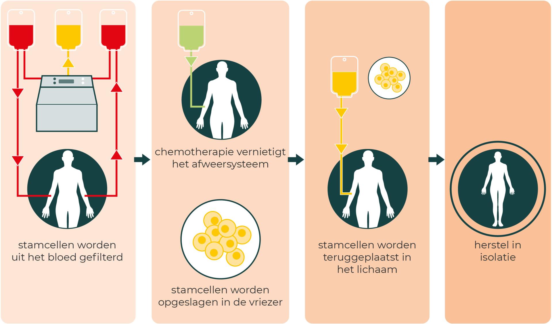 Stamceltherapie (aHSCT), hoe gaat de behandeling? - MS.nl